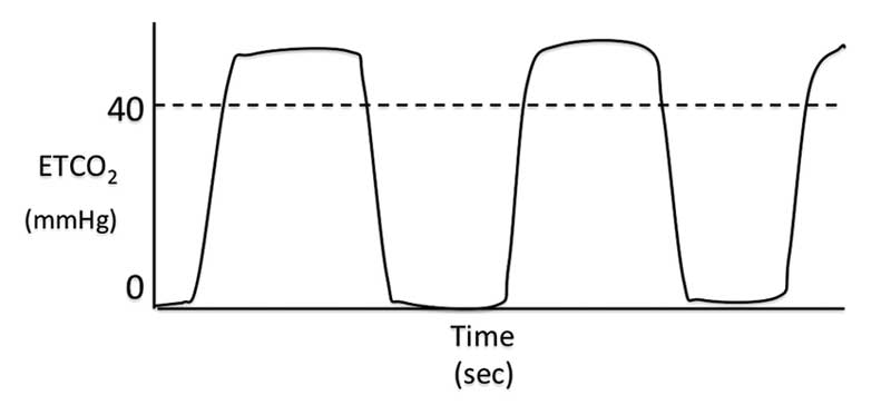 Understanding capnography | Vet Times