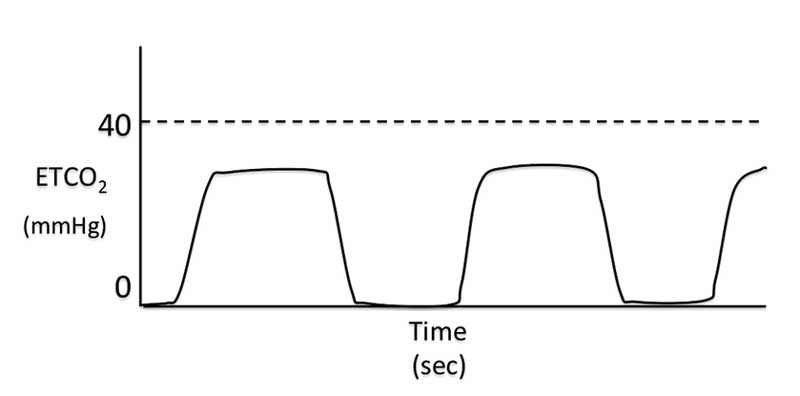 Understanding capnography | Vet Times