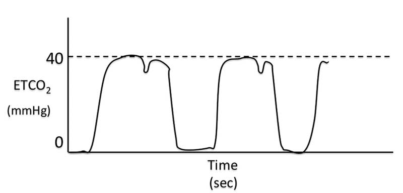 Understanding capnography | Vet Times