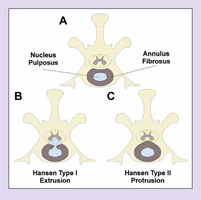 NEUROLOGICAL EXAMINATIONS: SPINAL DISEASES TO CONSIDER | Vet Times