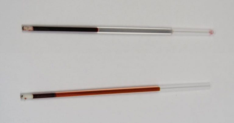 PCV/total solids: getting the most from simple test | Vet Times