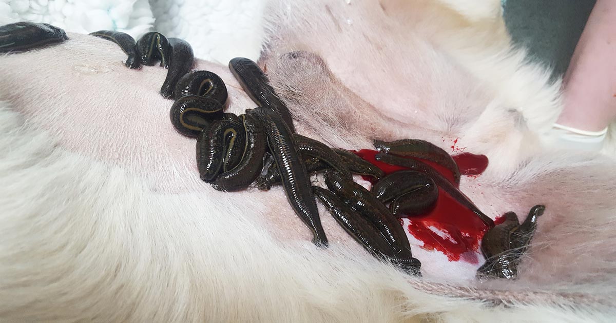 Leech Therapy