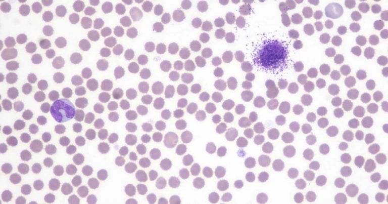 Blood smear findings in a dog | Vet Times