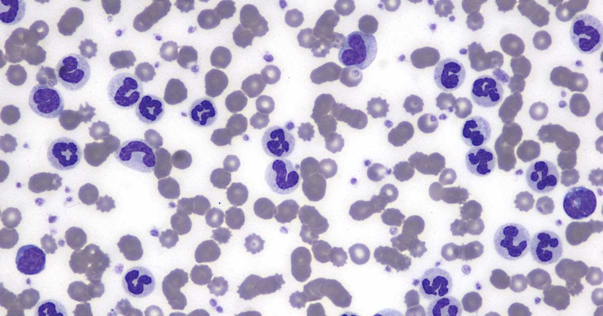 Canine Toxic Neutrophils