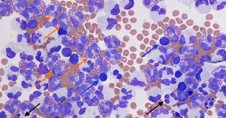 Cytology findings from an abdominal effusion in a dog | Vet Times
