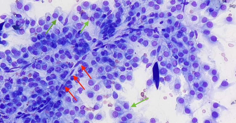 Cytology findings from a leg skin mass in a dog | Vet Times