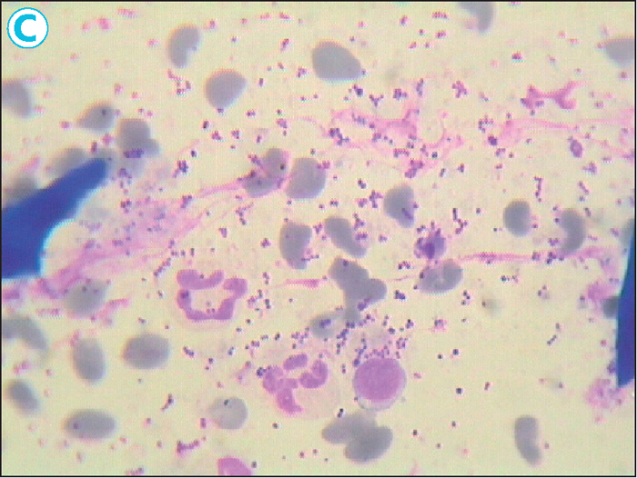 Management of otitis externa and otitis media in dogs | Vet Times