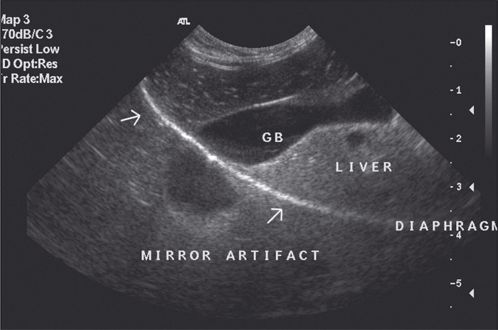 ABDOMINAL ULTRASONOGRAPHY: PRACTICE MAKES PERFECT SENSE | Vet Times