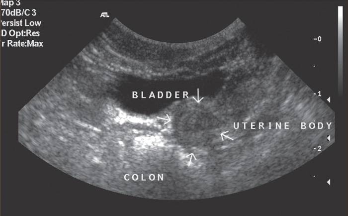 ABDOMINAL ULTRASONOGRAPHY: PRACTICE MAKES PERFECT SENSE | Vet Times