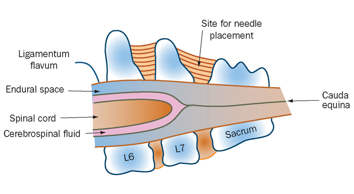 Epidural anaesthesia and analgesia | Vet Times