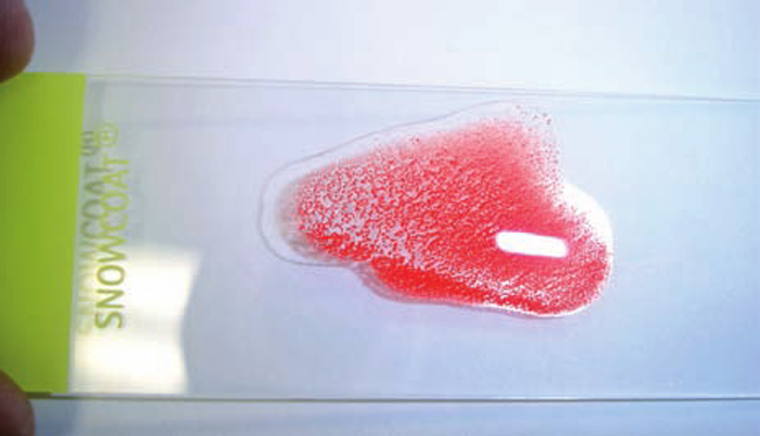 Immune-mediated haemolytic anaemia | Vet Times