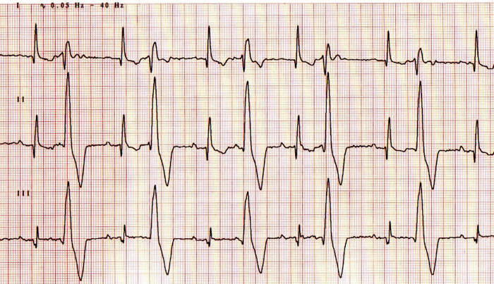 ADVANCES IN UNDERSTANDING OF CANINE DILATED CARDIOMYOPATHY | Vet Times
